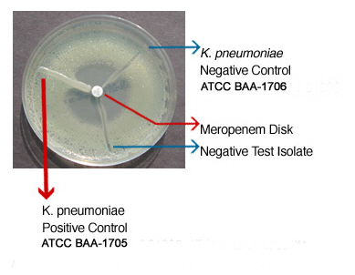 카바페넴 내성 장내세균 진단검사 - Modified Hodge Test (MHT)