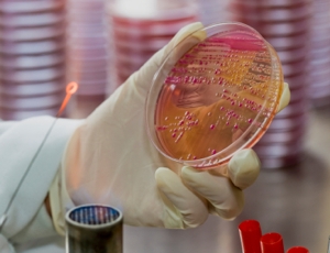 카바페넴 내성 장내세균 진단검사 - Modified Hodge Test (MHT)